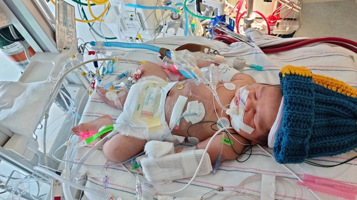 Fundraiser by Alex Mironov : Ayden's CDH repair surgery and medical costs