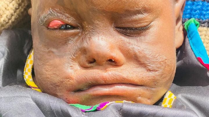 Fundraiser by Hallie F : Help Save Queen with Life-Saving Surgery