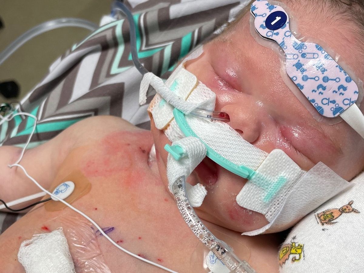 Fundraiser for Amy Gallagher by Jennifer McCubbin : Baby Iva Lynn CDH ...