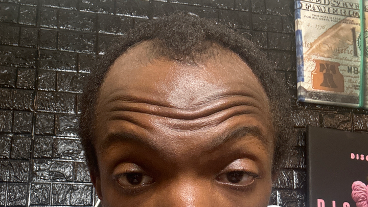 Fundraiser by Cortez Macklin : From Laughs to Locks: Support Cortez’s Hair Growth Journey