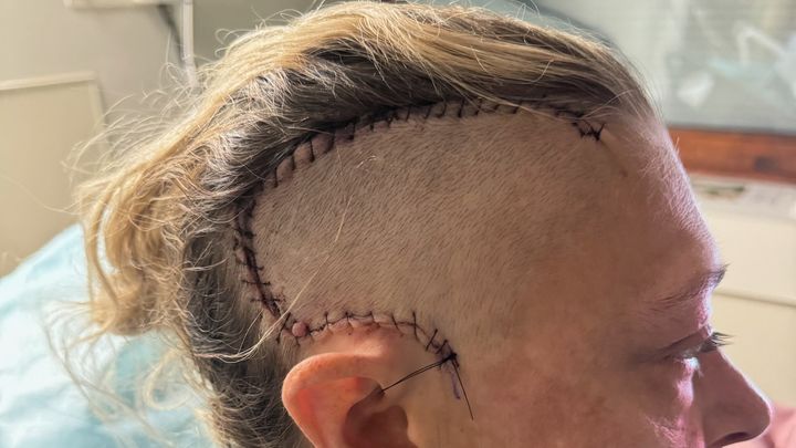 Fundraiser by Kirstie Davis : Shay Strong - Help with Shay's Fight ...