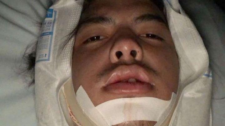 Fundraiser for Kobe La by ELIZABETH PHU : Help student injured in ...