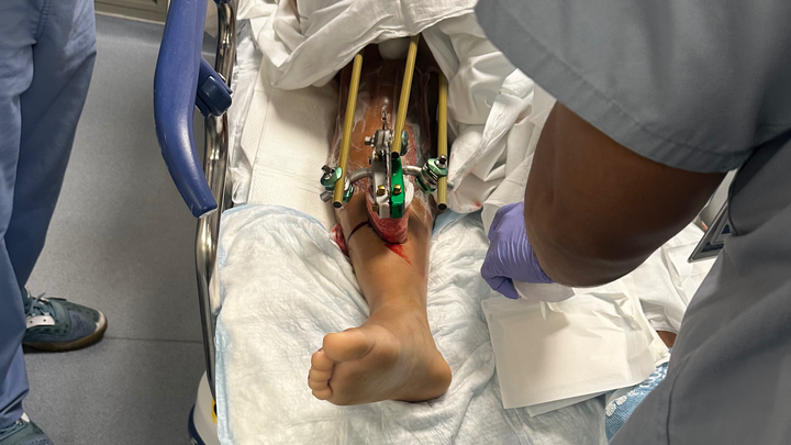 Fundraiser for Ellie Martinez by Jessica Johnson Sprouse : Help Taylor ...