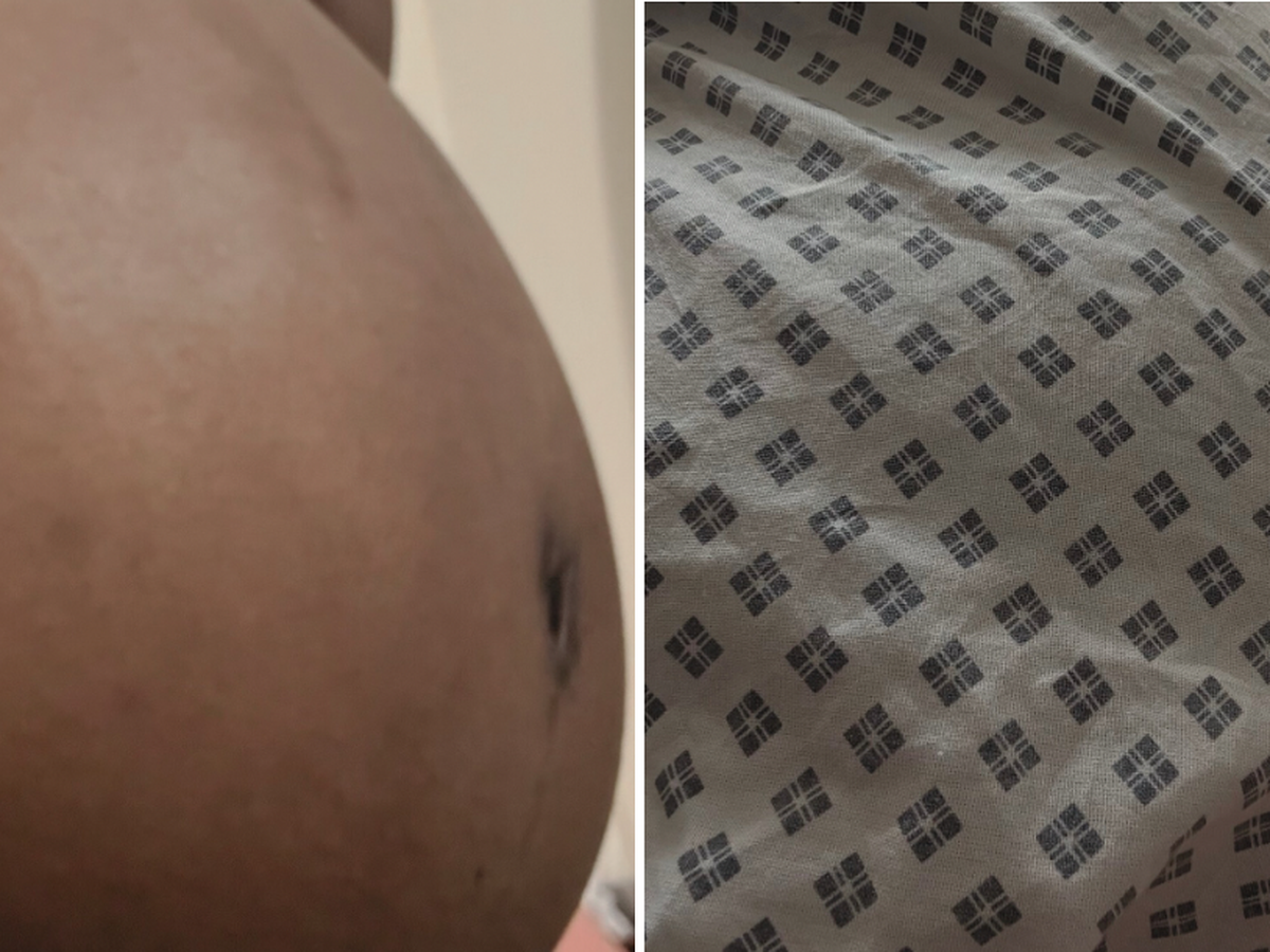 Fundraiser by LUA Achu : A Little Support for a Quiet Fighter in Recovery