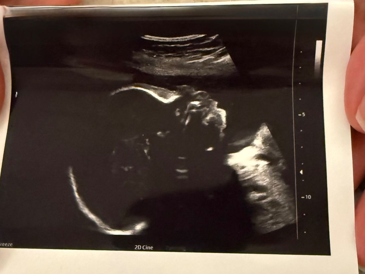 Fundraiser by April Riddle : Support for Chelsea’s Family & Early Arrival