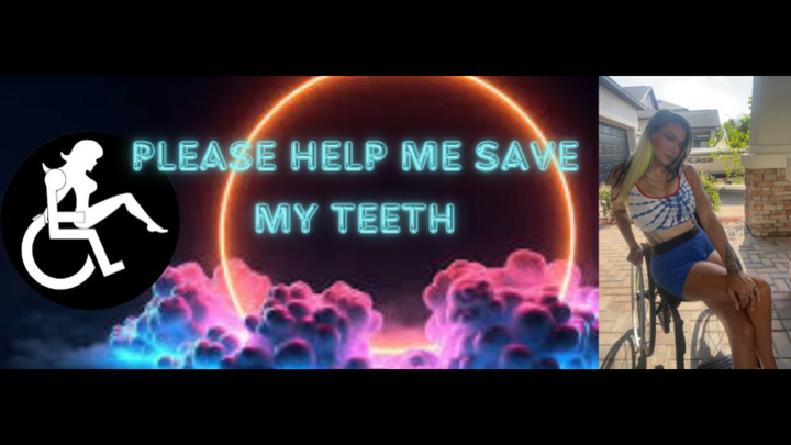 Fundraiser for S S by B Banks : Help me save my teeth