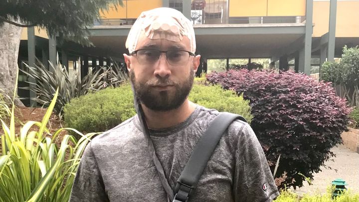 Fundraiser for Casey Reno by Mary Reno : Help Casey with quality of ...