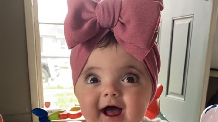 Fundraiser by Brittany Rothstein : Support for Rylee's Head Surgery!