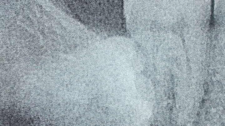 Fundraiser by Michael Manier : Help Val get his wisdom tooth removed!