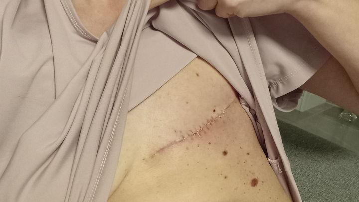 Fundraiser for Chiara und Alessio by JULIA COLETTA-POHL : Krebsmedikament