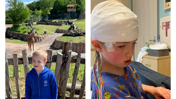 Fundraiser by James Acuff : Help Benjamin Overcome Focal Cortical Dysplasia