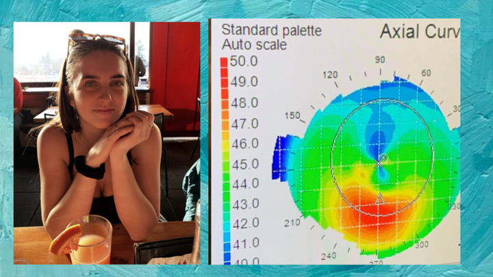 Fundraiser by Lauren Valenti : Eye Surgery for Lauren