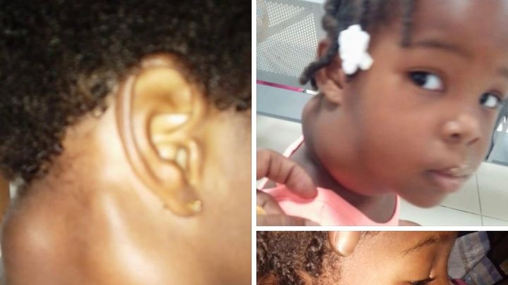 Fundraiser by Vina Joseph : Help Myra Edwards Get Life-Saving Surgery
