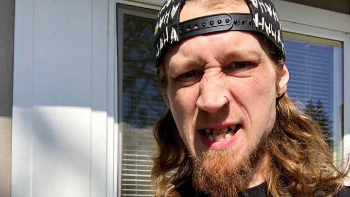 Fundraiser by Jackson Goodman : Save a smile save a life