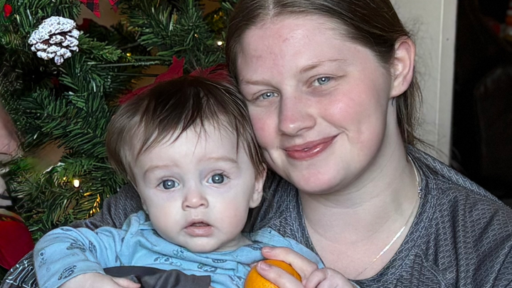 Fundraiser by Rebecca Jackson : Help My Nephew Get His Cranial Cap