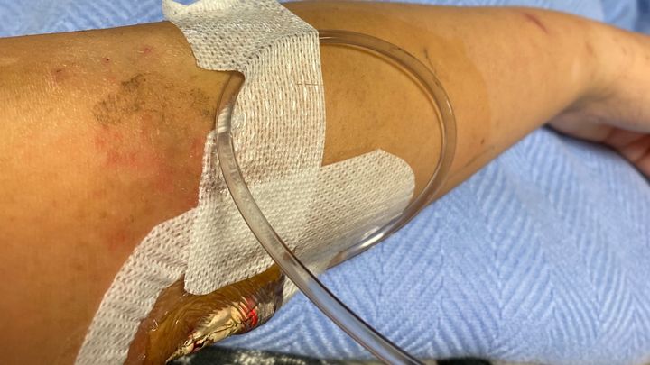 Fundraiser by Valerie Murad : Open heart surgery for myocardial bridge