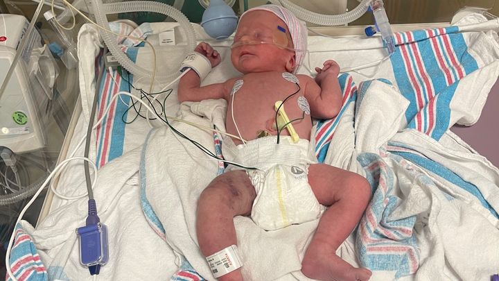 Fundraiser by Kerry Nation : Baby Logan’s Medical Expenses