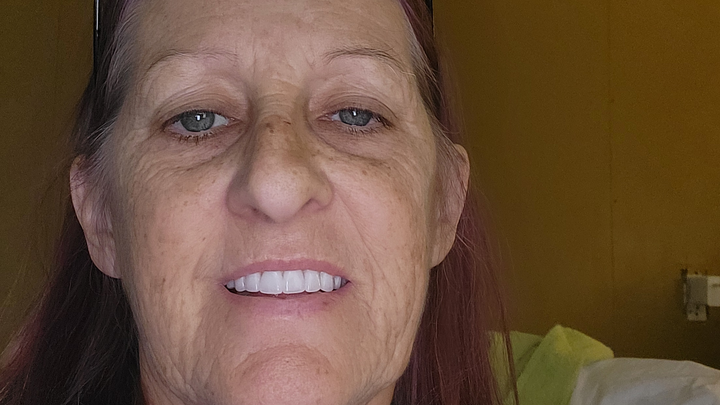 Fundraiser by Catherine Burns : Support Cat Burns' Heart Surgery Recovery