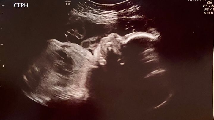 Fundraiser by Renee McCullough : Bierman family and Calum Haze Bierman