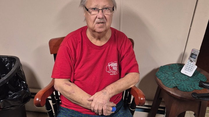 Fundraiser for Gary English by Gary English : Help Barry Live With ...