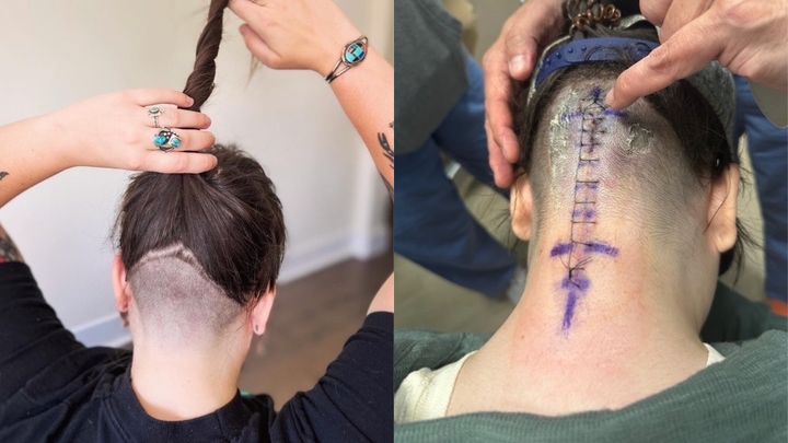 Fundraiser for Ashlyn Evans by Savanna Evans : Ashlyn Chiari ...