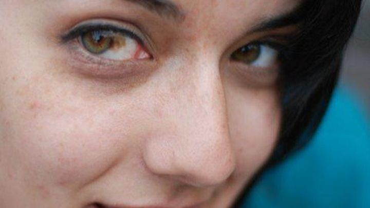 Fundraiser by Elizabeth Pizano : Ocular Eye Biopsy & Surgeries